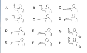 A New Type of Median Nerve Glides for Carpal Tunnel Syndrome