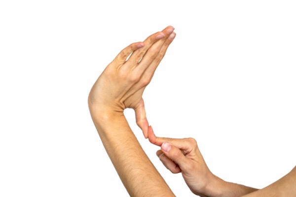 Ehlers-Danlos Syndrome: EDS Hands | Hand Therapy Academy