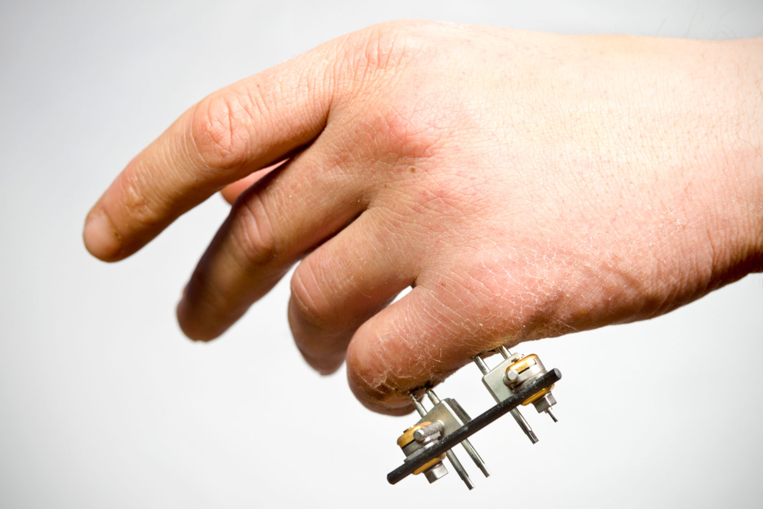 Pin Site Care Protocols | Hand Therapy Academy