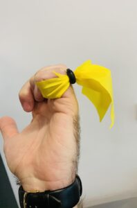 Top 6 treatments for Pinky Fracture | Hand Therapy Academy