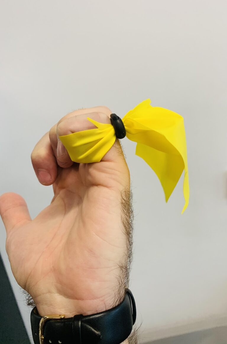 Top 6 treatments for Pinky Fracture | Hand Therapy Academy