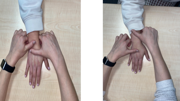Managing UE Edema in Hand Therapy | Hand Therapy Academy