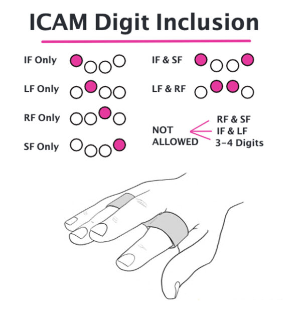Extensor Tendon Zones | Hand Therapy Academy