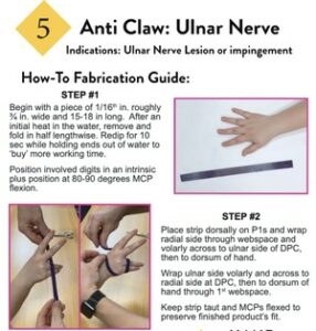 Hand Therapy Splinting | Hand Therapy Academy