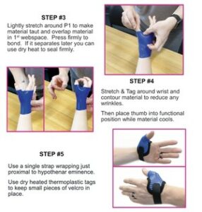 Hand Therapy Splinting | Hand Therapy Academy