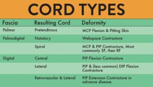 Discovering Dupuytren’s Disease | Hand Therapy Academy