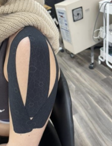 Kinesiology Tape for Shoulder Subluxation